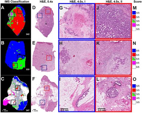 Partial Least Squares Discriminant Analysis Classifications Of Tissue