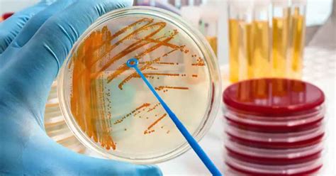 Streptokokus Kumpulan B Gbs Jangkitan Pemeriksaan Dan Rawatan Semasa