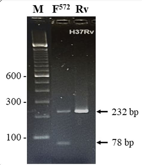 Agarose Gel Of Multiplex Allele Specific Mas Pcr Amplicons Obtained Download Scientific