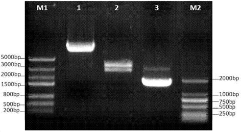 Recombinant Expression Plasmid And Application Thereof In Preparing