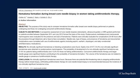 Stereotactic Biopsy Using Digital Breast Tomosynthesis Els