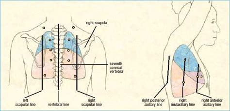 Scapular Line