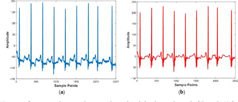 Figure 1 From A Novel Electrocardiogram Biometric Identification Method Based On Temporal