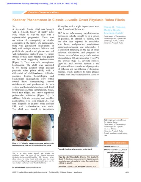 Pdf Koebner Phenomenon In Classic Juvenile Onset Pityriasis Rubra Pilaris