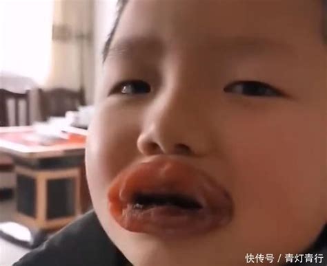 湖北一儿子吃辣条嘴巴肿成香肠嘴，儿子委屈得想哭，爸爸忍不住笑 360娱乐，你开心就好