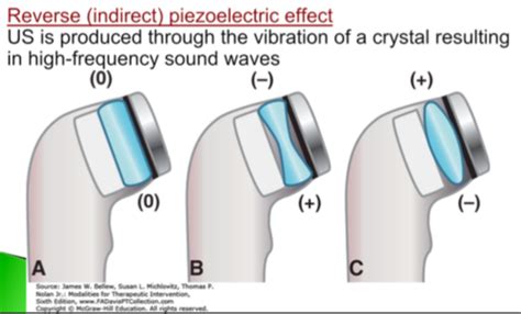 Ultrasound Flashcards Quizlet