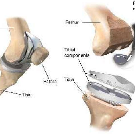 The Dimensions Of The Initial Tibial Components Figure 5 The Loading Download Scientific