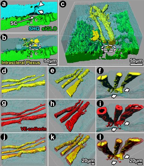 isosurface mapping and 3 dimensional reconstruction of distal aqueous