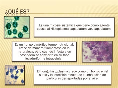 Ppt Histoplasmosis Powerpoint Presentation Free Download Id5458093