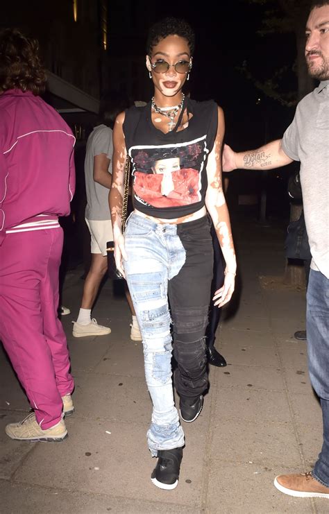 Winnie Harlow