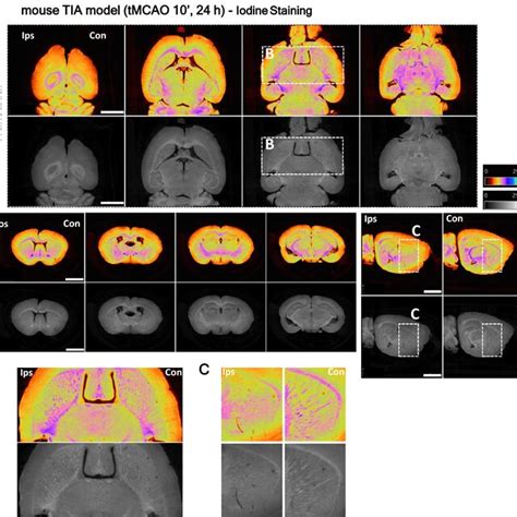 Visualization Of Brain Lesions In Mouse Stroke Model Tmcao By