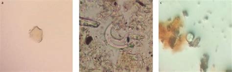 A B C Selected Phytoliths And Starch Grains Identified In Dental