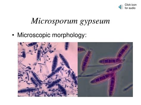 Microsporum Gypseum