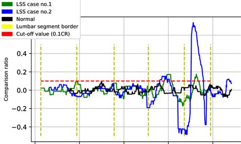 Lumbar Spinal Stenosis Detection Using Comparison Ratio Download
