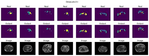 UW Madison GI Tract Image Segmentation Report Uw Madison Weights