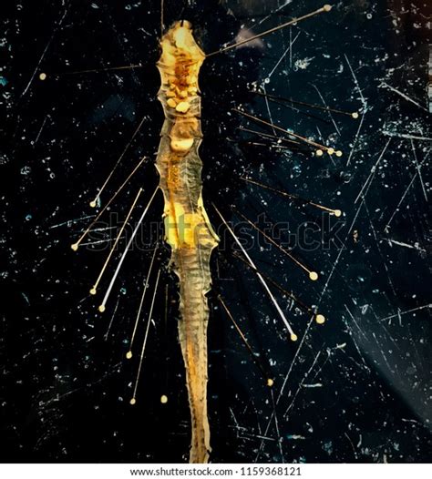 Lumbricus Dissection