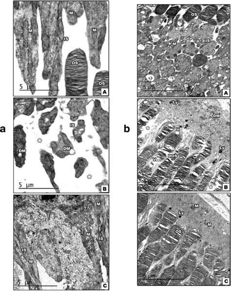 A Transmission Electron Microscopy Tem Of Retinal Rod Inner Segment