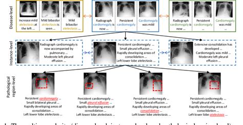 Figure 1 From Multi Granularity Cross Modal Alignment For Generalized