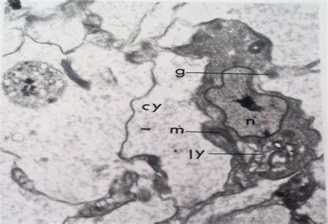 Section From A 34 Day Old Worm A Cortison Treated Mouse