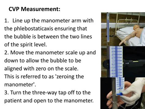 What Is A Cvp Line