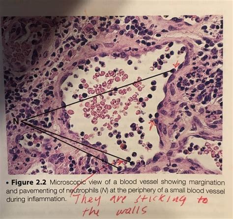 Pathology Final Exam Jeopardy Board Questions Flashcards Quizlet