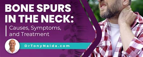 Bone Spurs In The Neck Causes Symptoms And Treatment