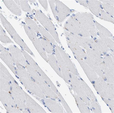 Rabbit Polyclonal Anti Sgsh Antibody Buy For Research Highly