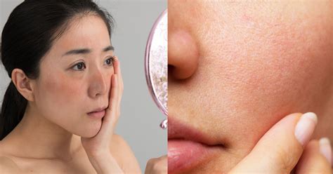 換季敏感怎麼辦？「洗面乳」如何挑？小心洗後xx分鐘後就會流失水分！美妍小百科 好日子