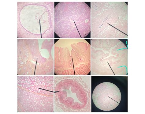 Reproductive And Urinary Tissues Quiz