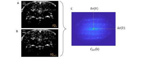 cross correlation in the rat s brain a reference frame b displaced