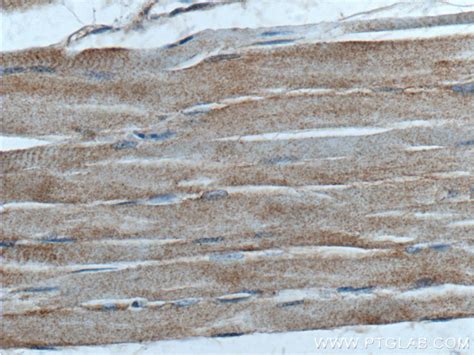 Eya4 Antibody 24691 1 Ap Proteintech 武汉三鹰生物技术有限公司
