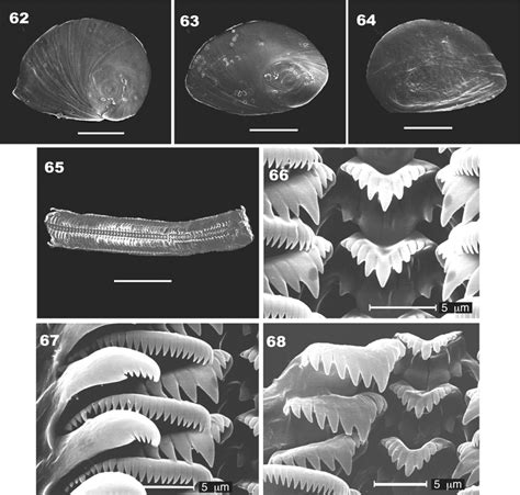 −68 Operculum And Radula Of Islamia Ateni 63 Outer Side Of The