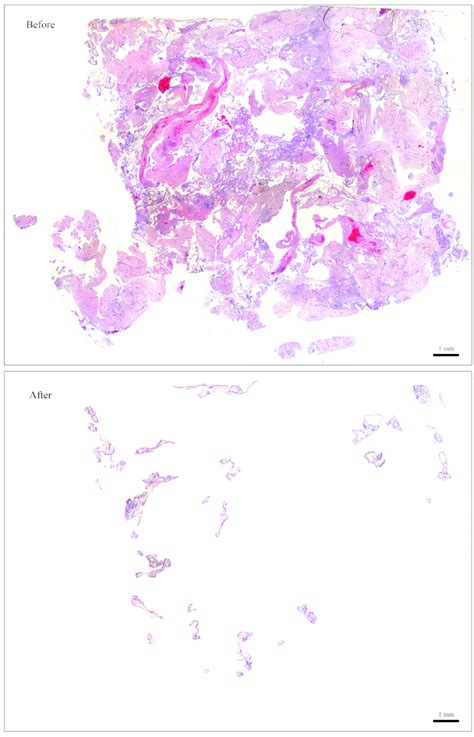 Microsatellite Dna Genotyping And Flow Cytometry Ploidy Analyses Of Formalin Fixed Paraffin
