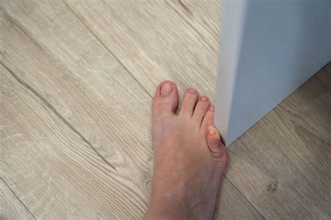 여자는 작은 발가락가구를 쳤다 집에서 사건 발 새끼 손가락의 부상 발가락에 대한 스톡 사진 및 기타 이미지 발가락 슛