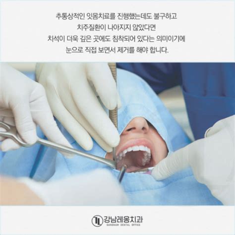 심한 치주질환은 잇몸수술 필요합니다 잇몸 절개 후 치료하는 치은박리소파술 원장님 칼럼 강남레옹치과