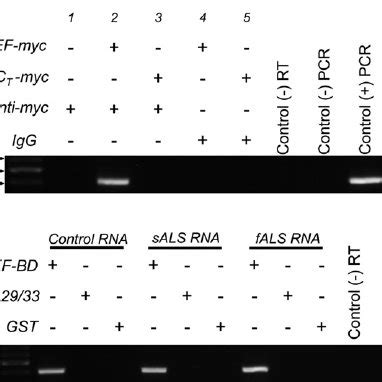 Rho Guanine Nucleotide Exchange Factor RGNEF Colocalizes With