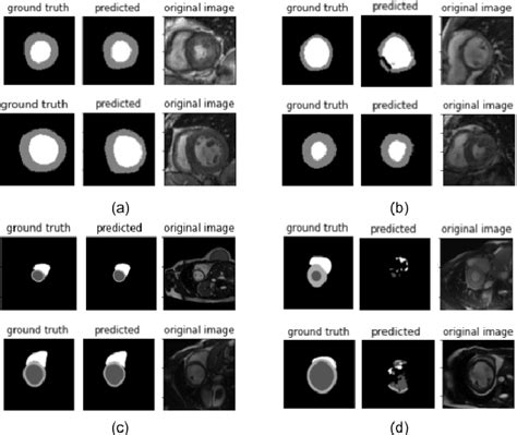 Figure 8 From Semi Supervised Segmentation Of Multi Vendor And Multi Center Cardiac Mri
