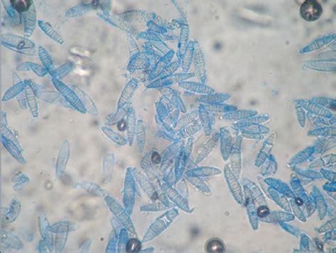 Microsporum Gypseum