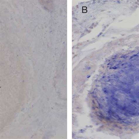 Quercetin Induced Melanin Content In Hair Follicle Observed After