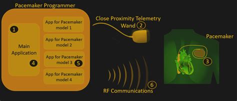 Radio Controlled Pacemakers Are Easily Hacked Hackaday