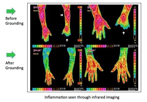 Does Grounding Really Work The Science Of Earthing And Inflammation