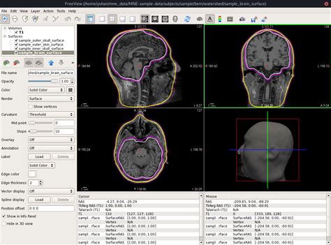 Mnebemmakewatershedbem Coordinate System Error · Issue 7570 · Mne Toolsmne Python · Github