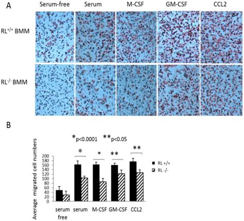 A Rnase L Deficient And Wild Type Bmms Were Seeded To The Upper