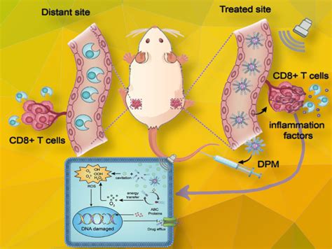 Optimized Sonodynamic Therapy For Inhibiting Tumor Resistance And