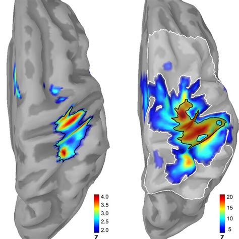 Quantitative Evaluation Of The Performances Of Mem And Mne