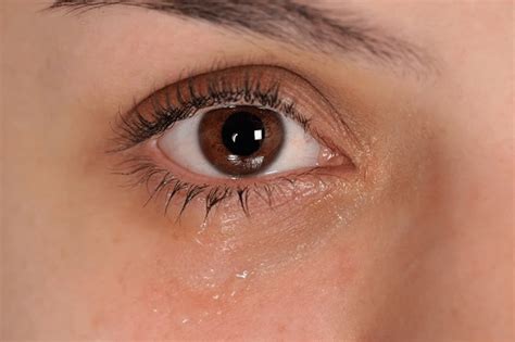 Why Do My Eyes Water A Lot When I See Bright Lights Book An Eye Test