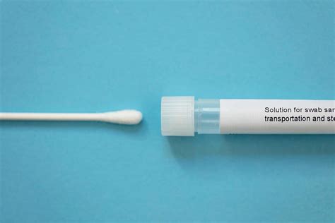 Younger People Open To Self Collected Testing For Sexually Transmitted