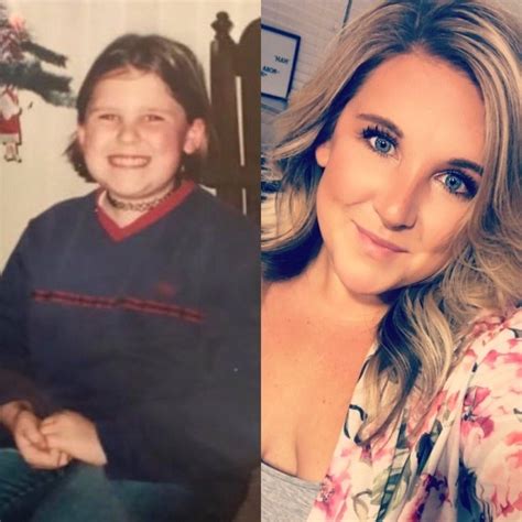 Puberty Glow Ups Before And After Pictures