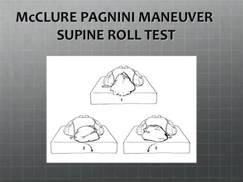 Bppv And Particle Repositioning Maneuvers