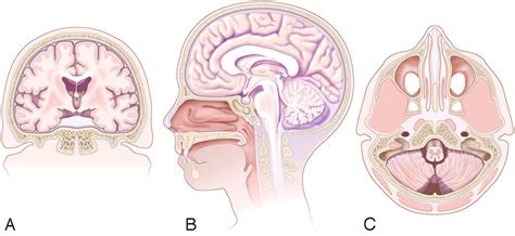 Illustration Showing The Fossa Navicularis Within The Clivus In Three